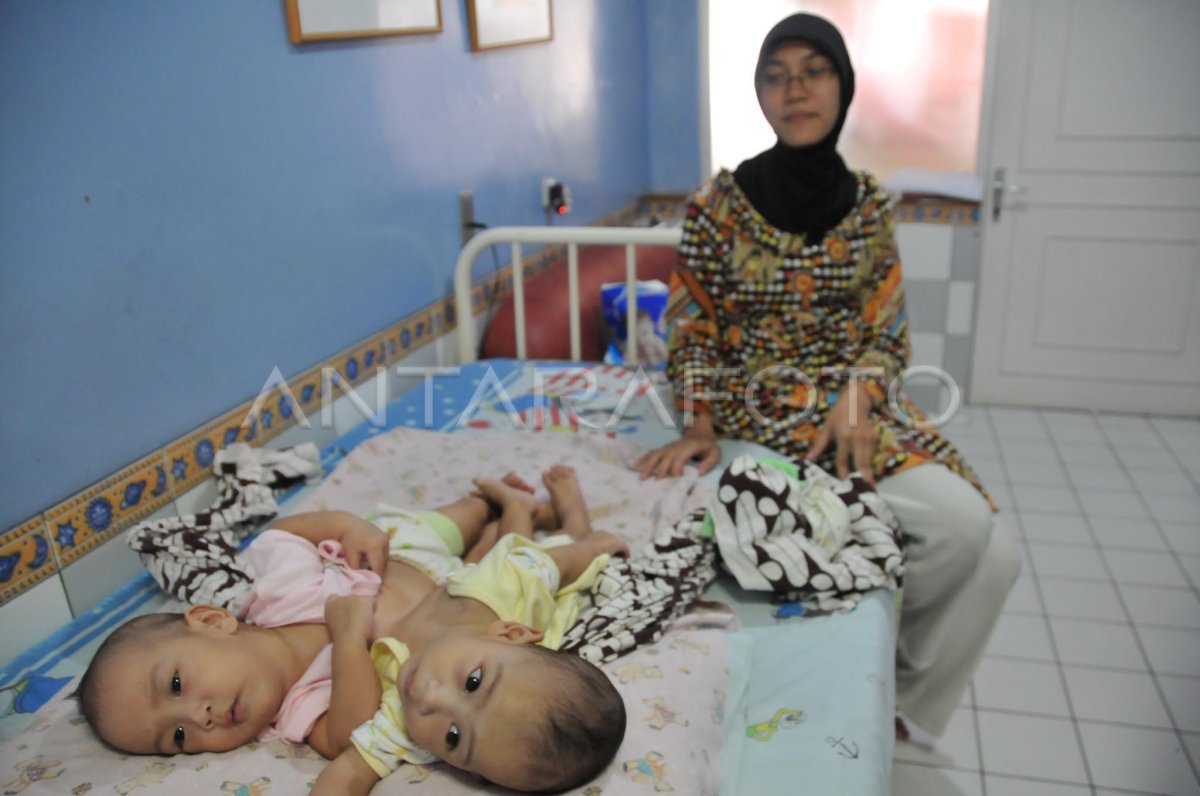 KEMBAR SIAM | ANTARA Foto