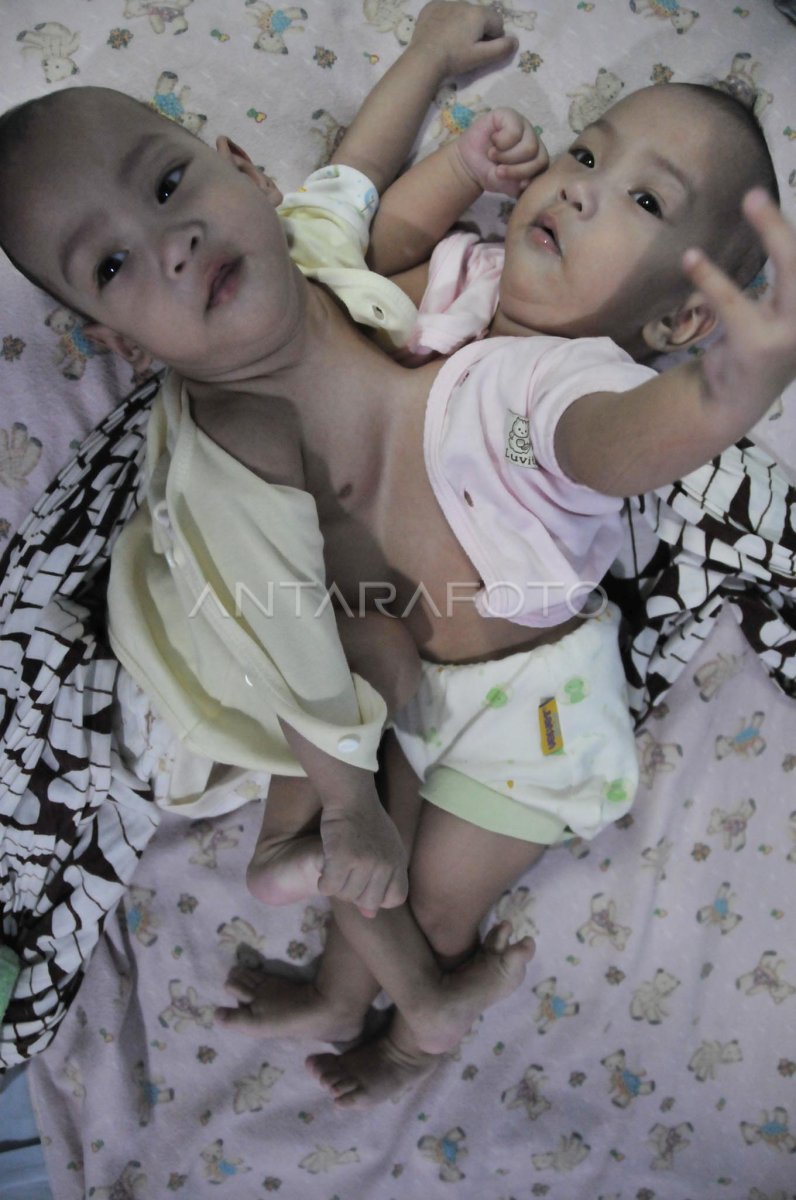 KEMBAR SIAM | ANTARA Foto