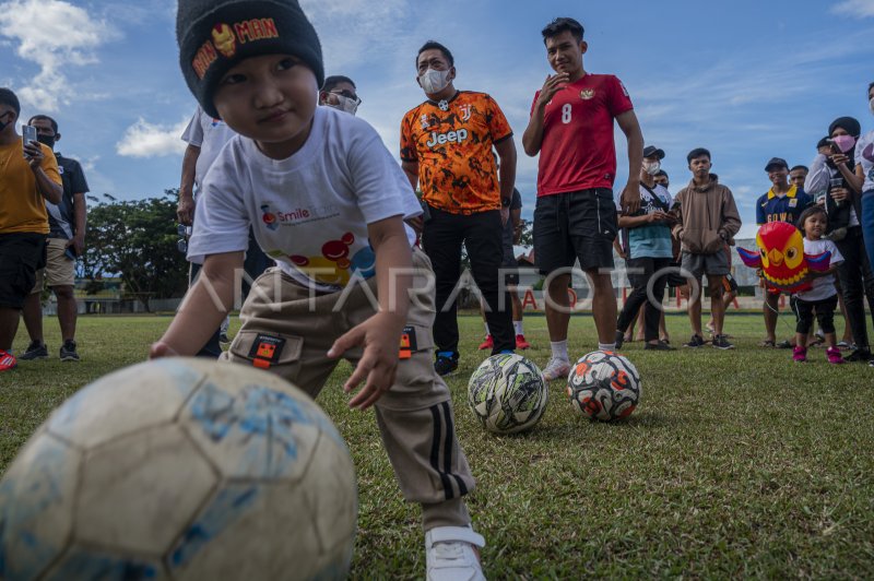 KAMPANYE STOP PERUNDUNGAN PENDERITA BIBIR SUMBING | ANTARA Foto KAMPANYE STOP PERUNDUNGAN PENDERITA BIBIR SUMBING | ANTARA Foto