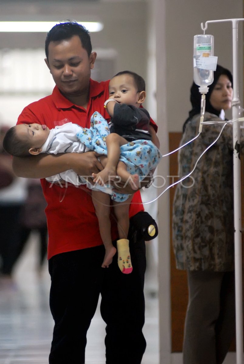 KEMBAR SIAM SIAP DIOPERASI | ANTARA Foto